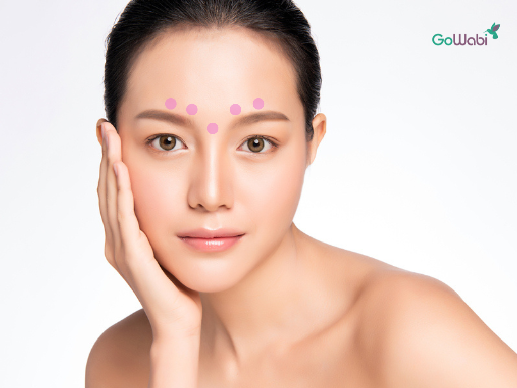 ทำความรู้จัก Allergan Botox ก่อนฉีดต้องรู้อะไรบ้าง Gowabi