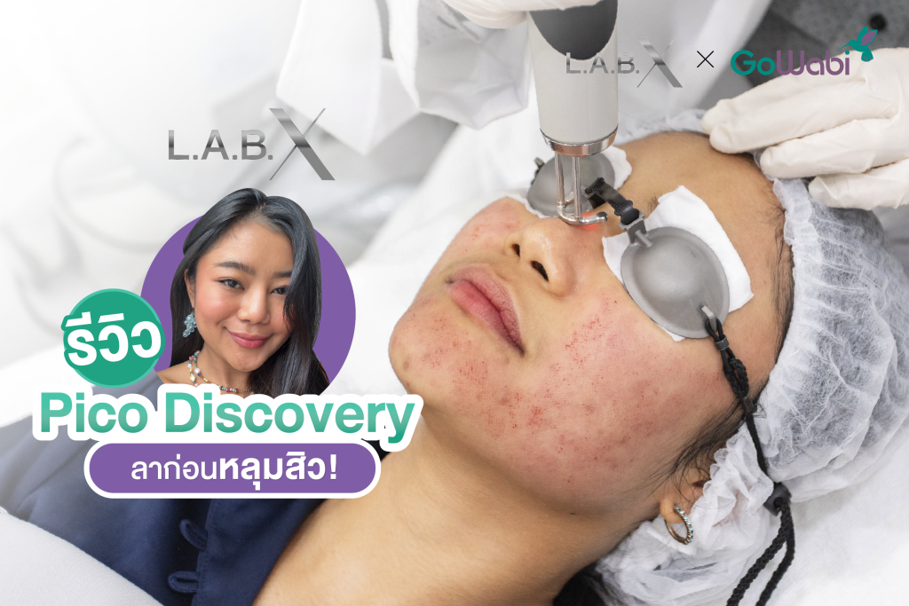 ลาก่อนหลุมสิว รีวิว L.A.B. X Clinic Pico Discovery คุ้มมากกก