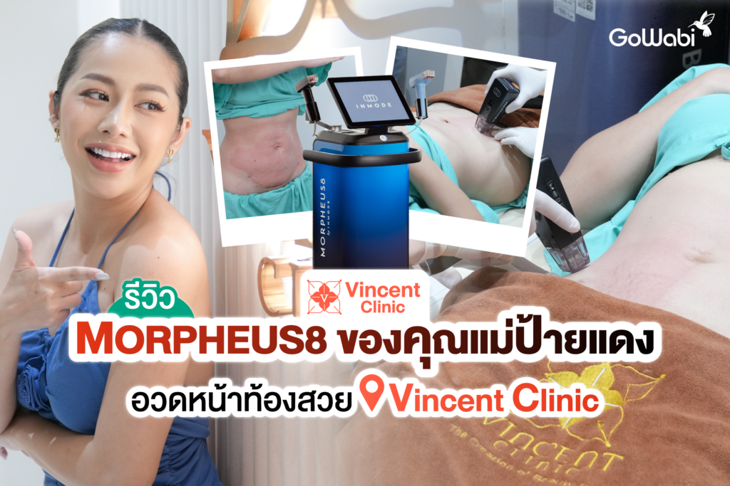 อวดหน้าท้องสวย! วินเซนต์ คลินิก รีวิว Morpheus 8 ของคุณแม่ป้ายแดง